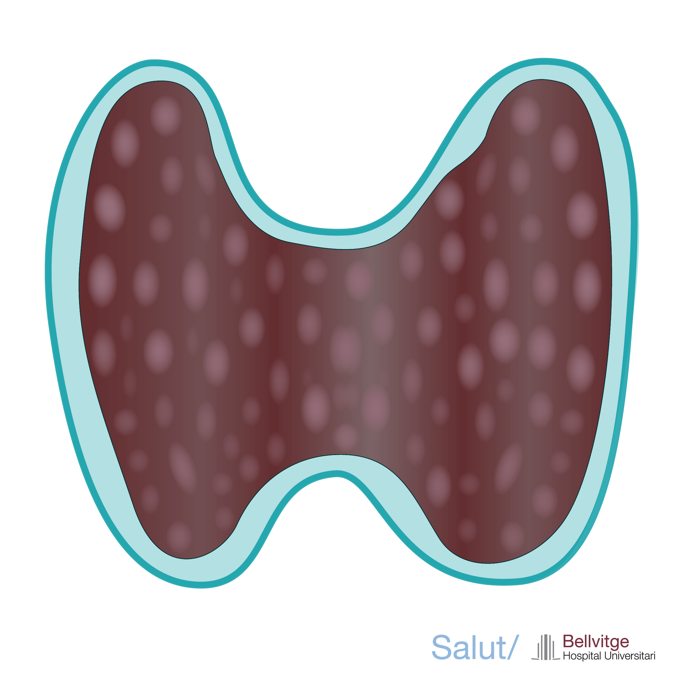 Tiroidectomía: principales detalles | Hospital de Bellvitge